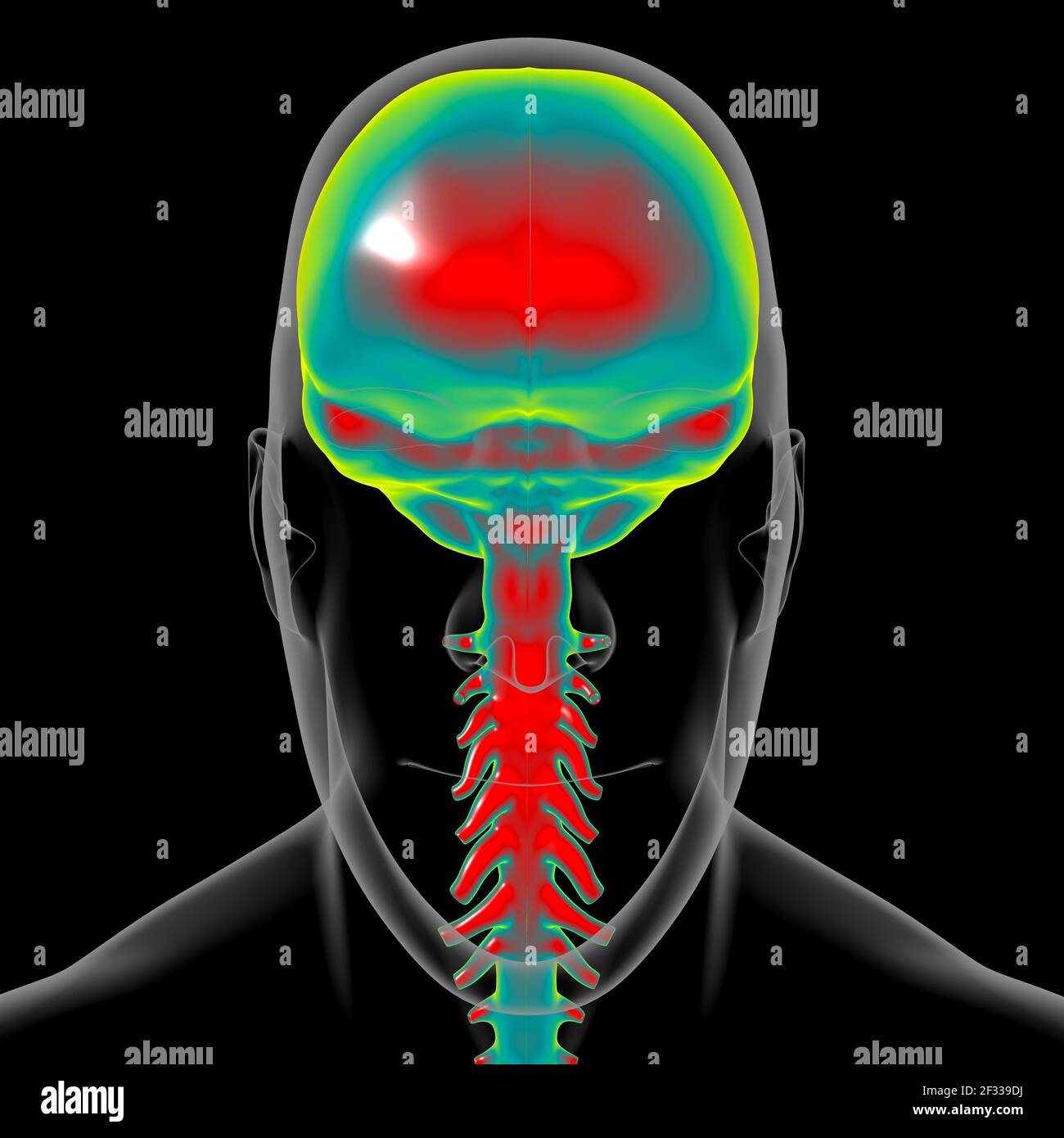 Dura Mater High Resolution Stock Photography and Images - Alamy