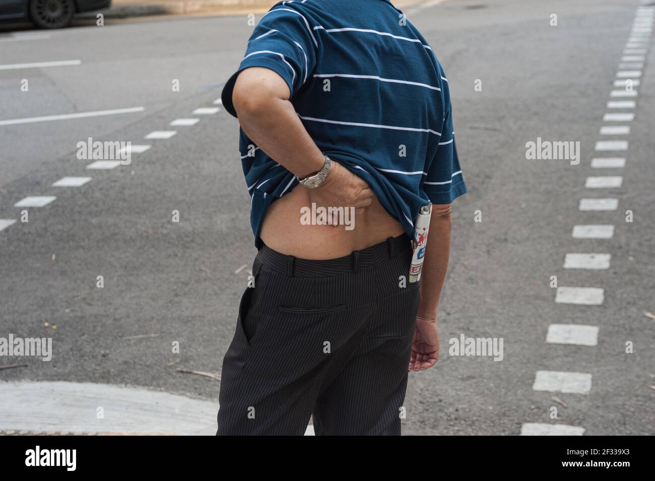 Back sprain hi-res stock photography and images - Alamy