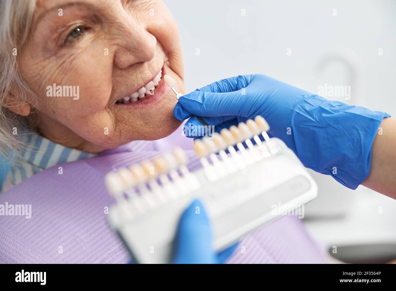 Person keeping a tooth shade next ot lady teeth Stock Photo - Alamy