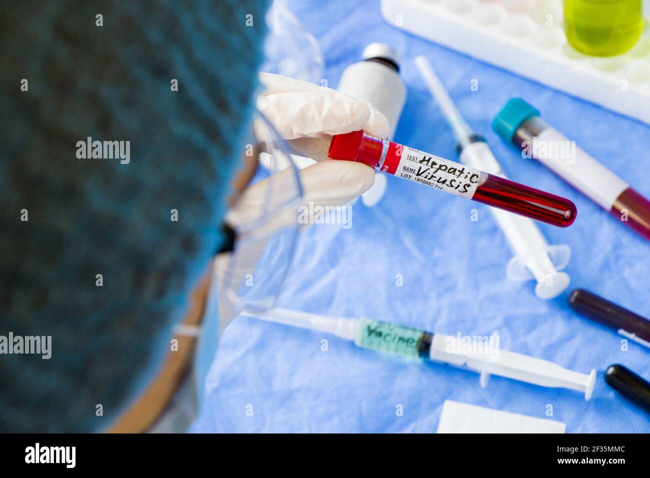 A doctor holding a Hepatic blood test tube sample in a laboratory Stock ...