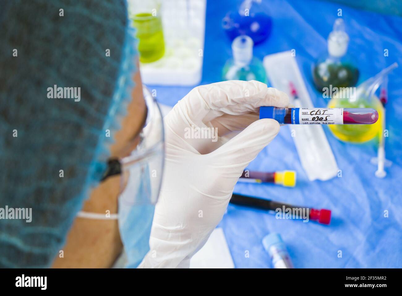 A doctor holding a CBC 0305 blood test tube sample in a laboratory ...