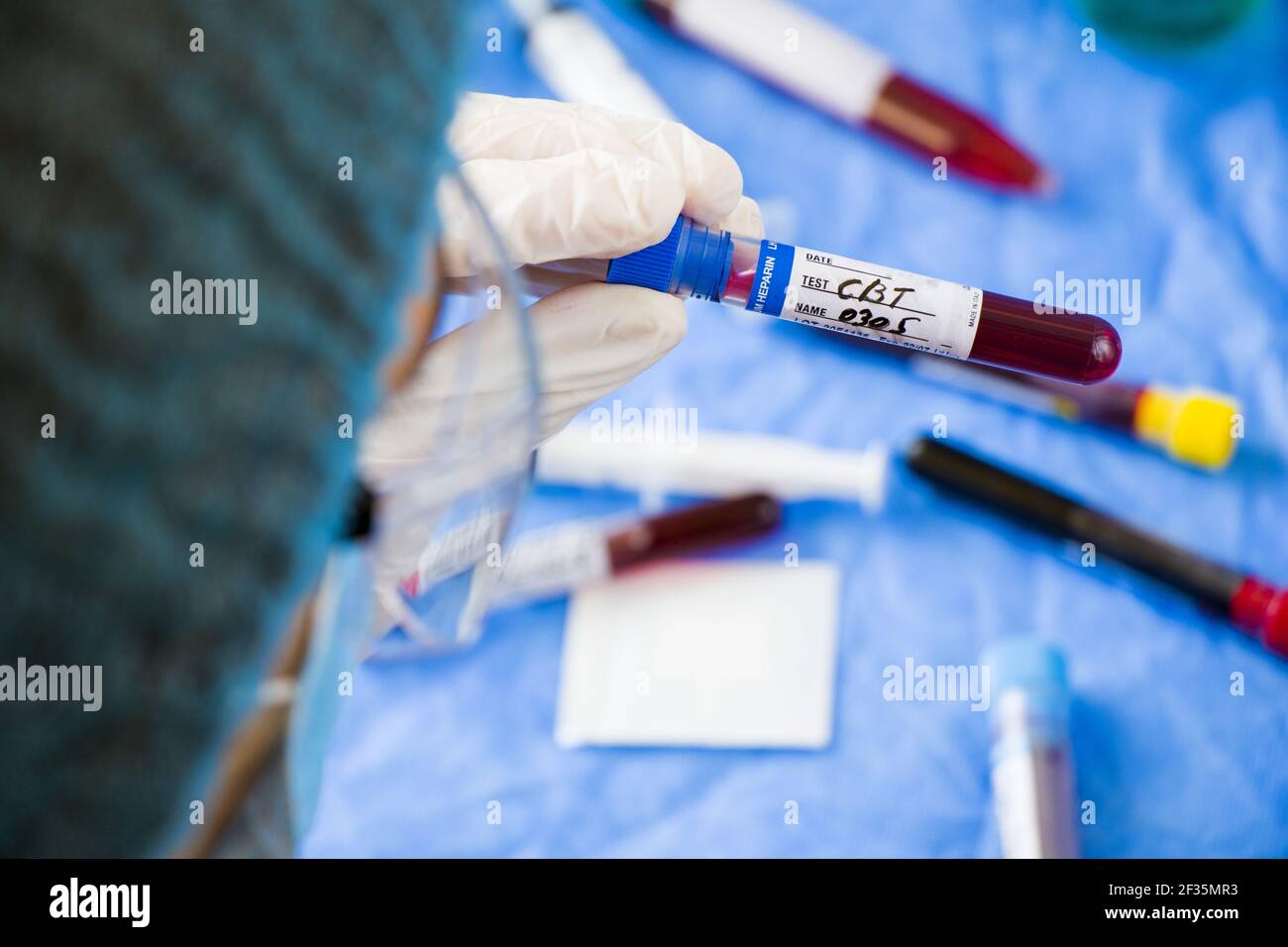 Blood test red tube report hi-res stock photography and images - Alamy