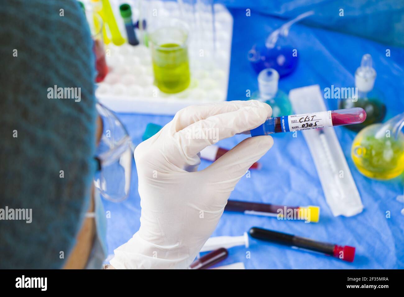 A doctor holding a CBC 0305 blood test tube sample in a laboratory ...