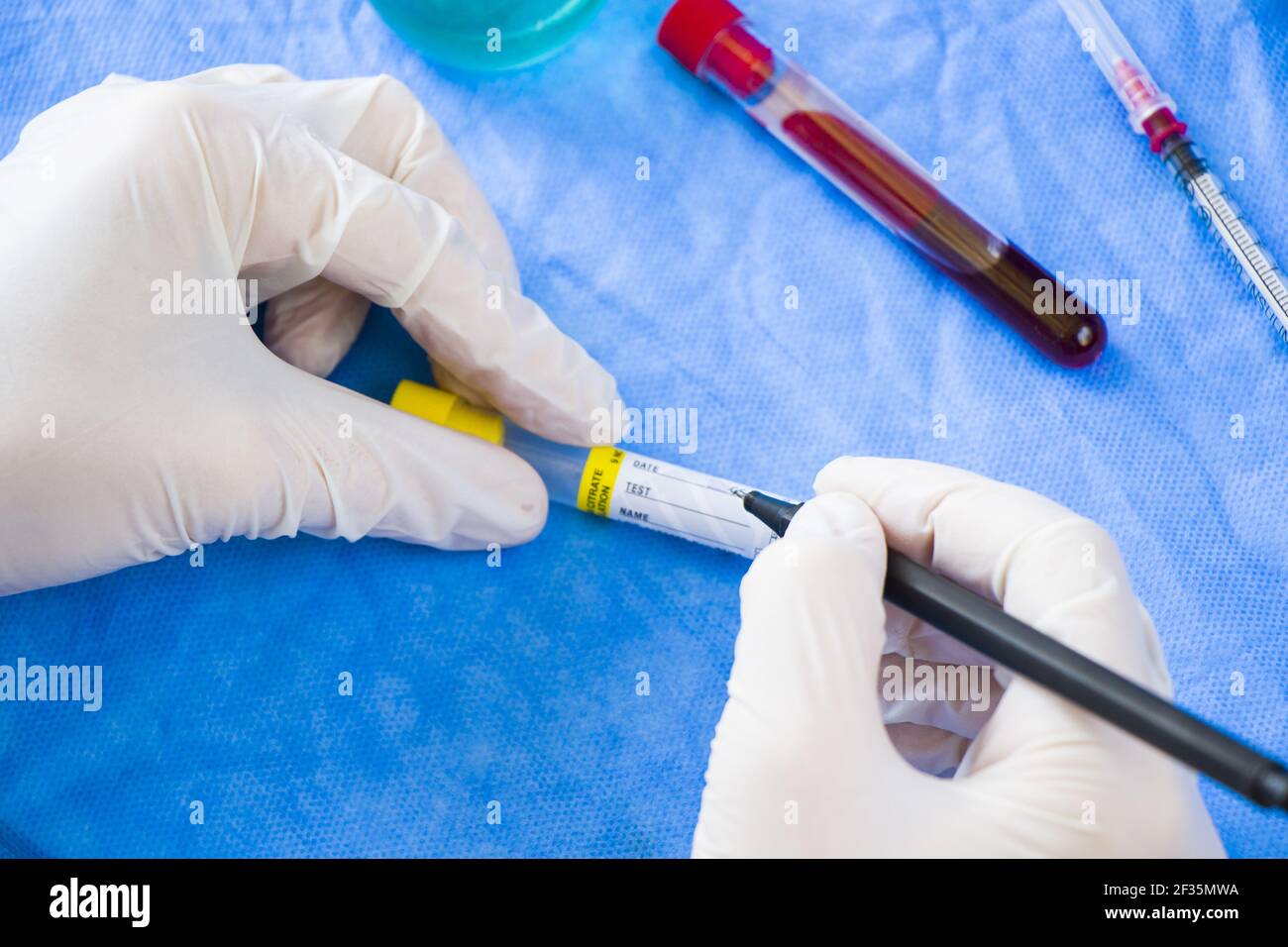 Positive negative blood samples hi-res stock photography and images - Alamy