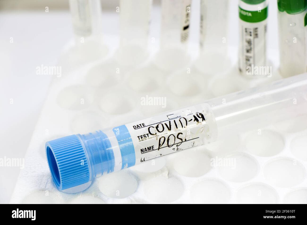A closeup shot of the Covid-19 virus empty test tube with other ...