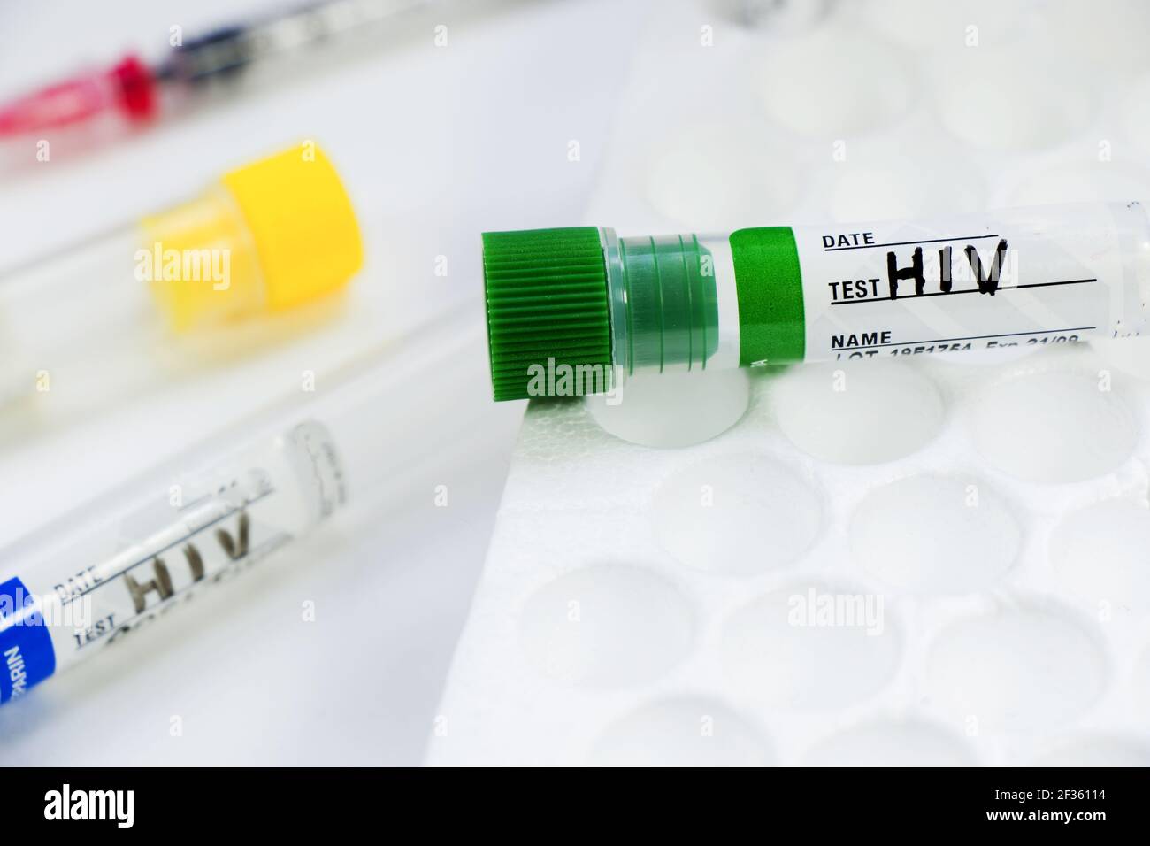 A closeup shot of the HIV and aids virus test tube with other ...
