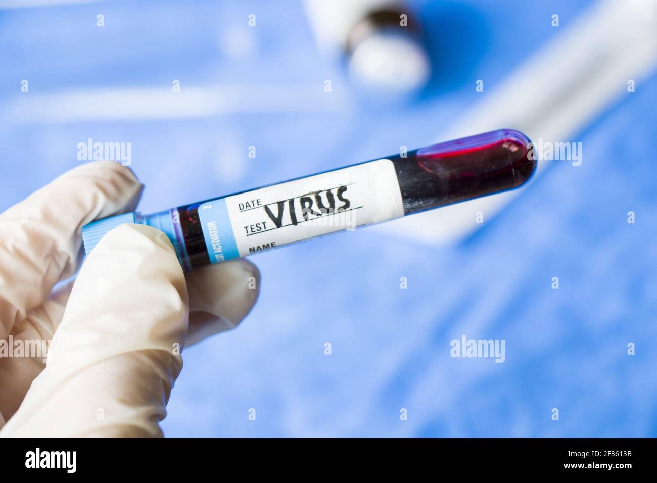 A closeup shot of a doctor's hand holding a blood test full tube for ...