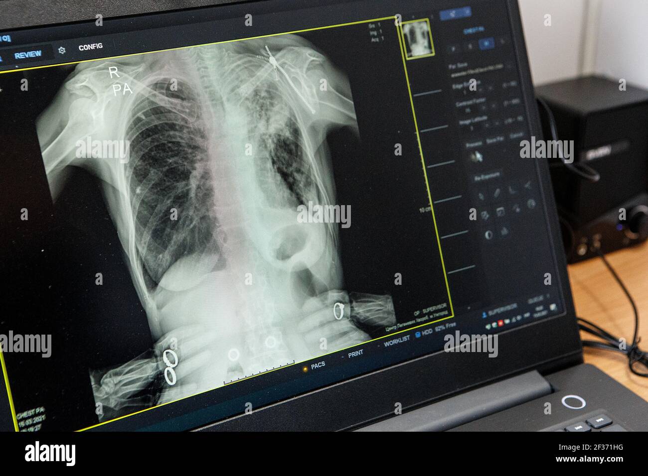 X ray center hi-res stock photography and images - Alamy