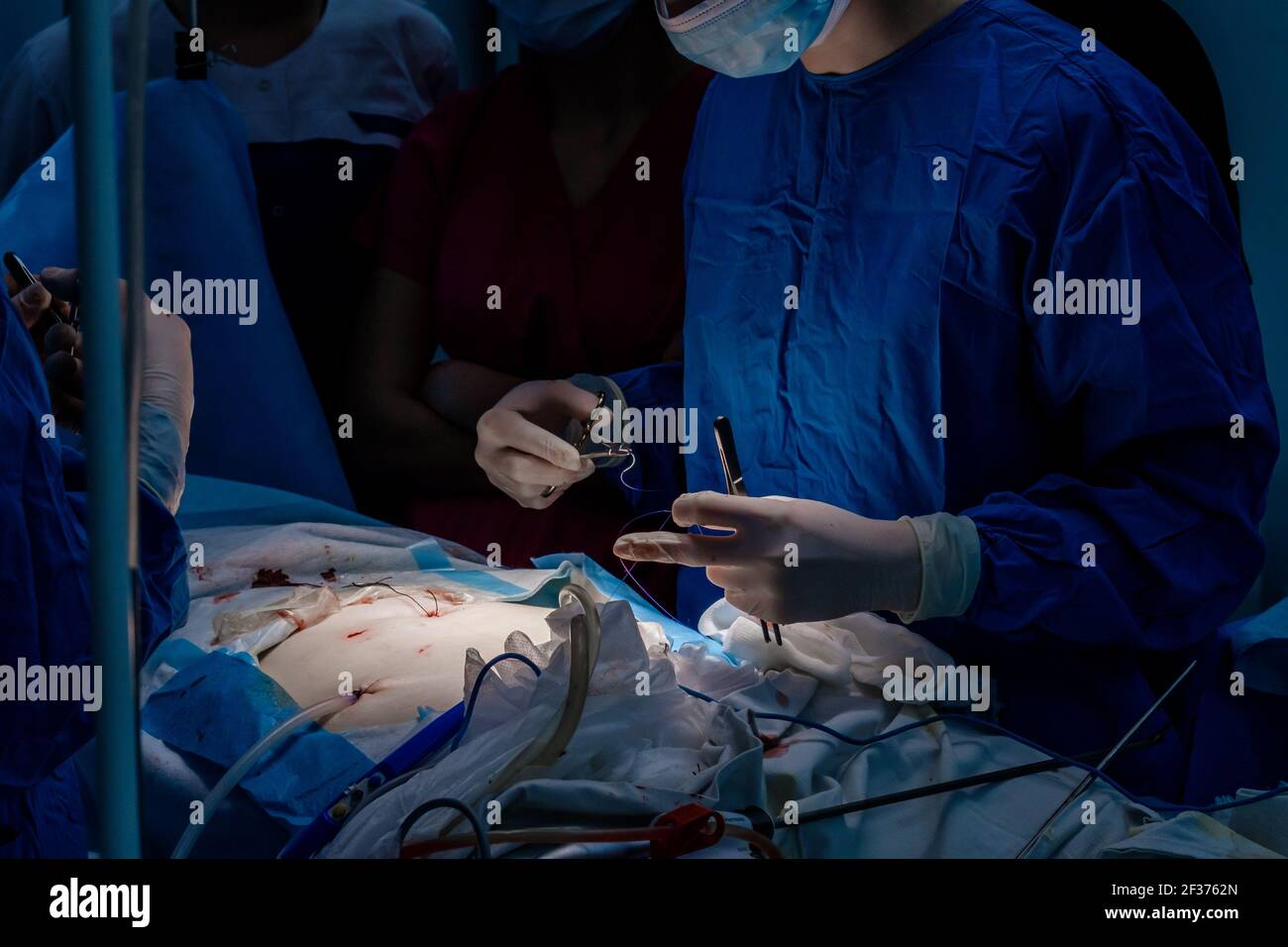 Doctors use medical instruments and metal thread to suture human skin ...