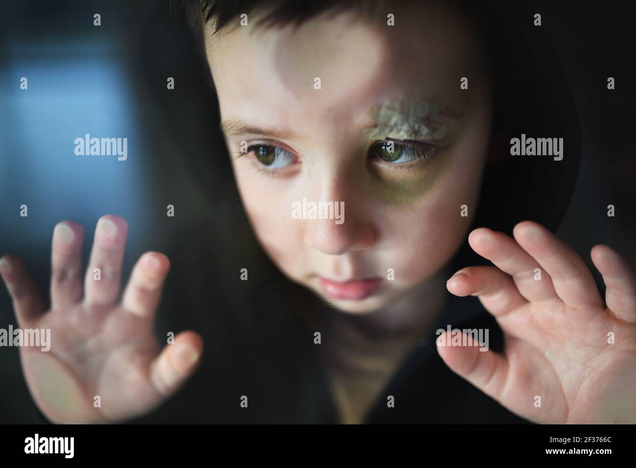 Poor sad small boy with cut eyebrow standing indoors at home, poverty ...