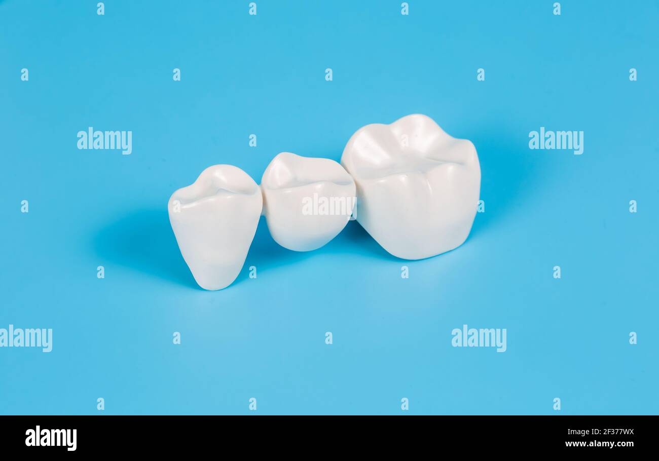 Plastic dental crowns, imitation of a dental prosthesis of a dental ...