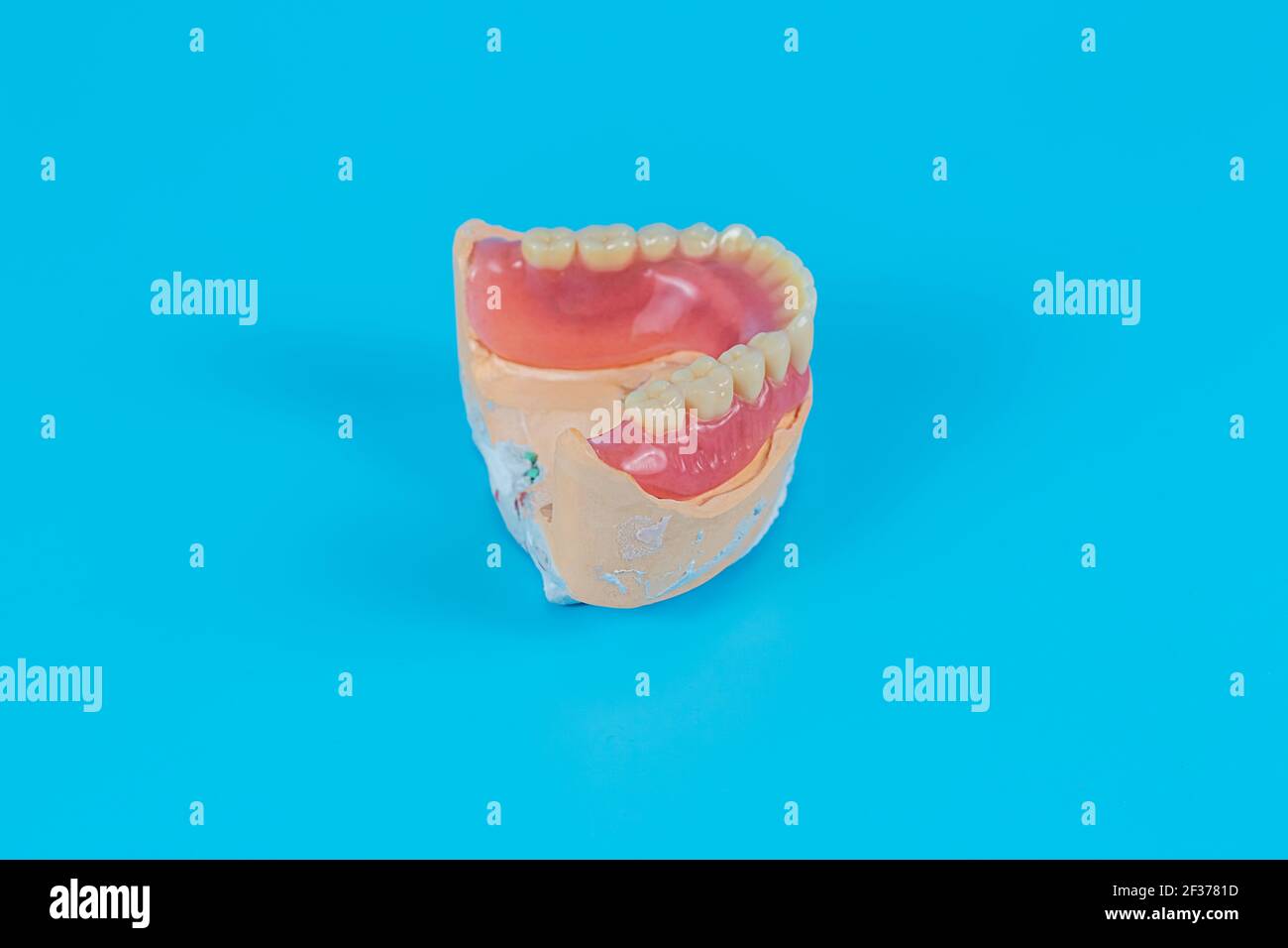 Plaster mock-up of the jaw with gums and teeth on a blue background ...