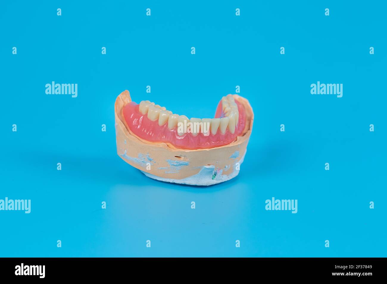 Plaster mock-up of the jaw with gums and teeth on a blue background ...