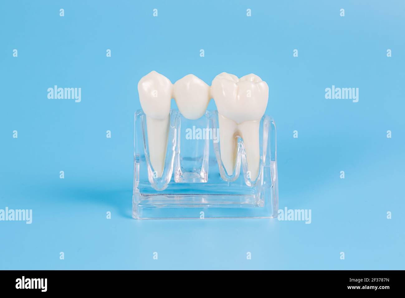 Plastic dental crowns, imitation of a dental prosthesis of a dental ...