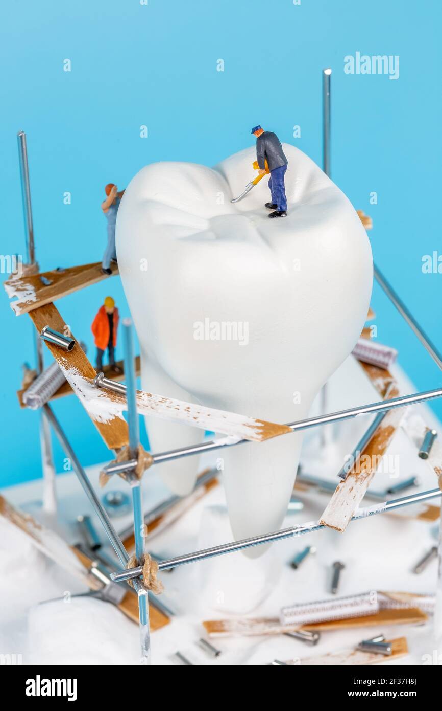 Moscow, Russia - 9th Matra 2021: A model of a human tooth and an art ...