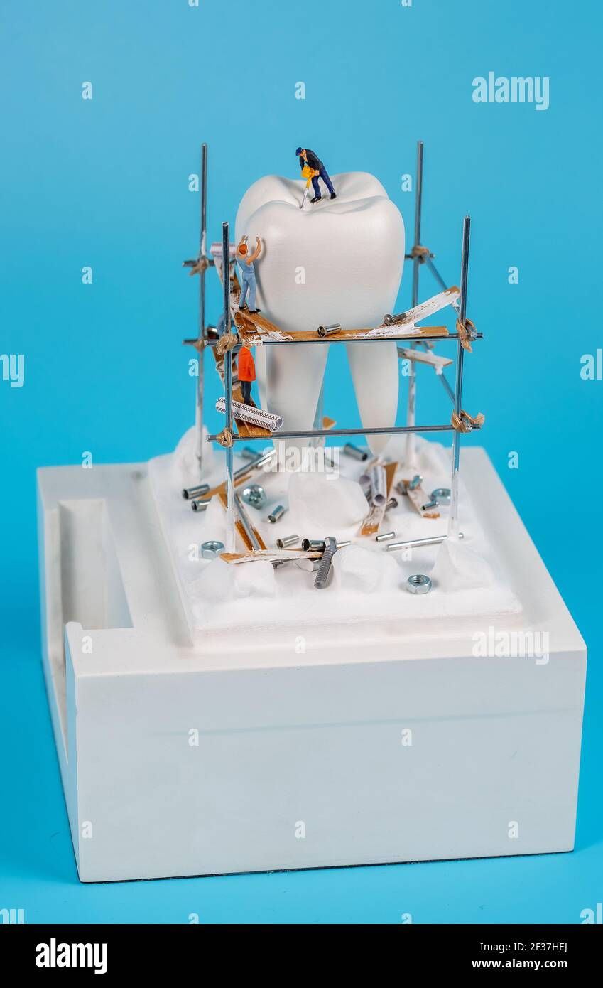 Moscow, Russia - 9th Matra 2021: A model of a human tooth and an art ...