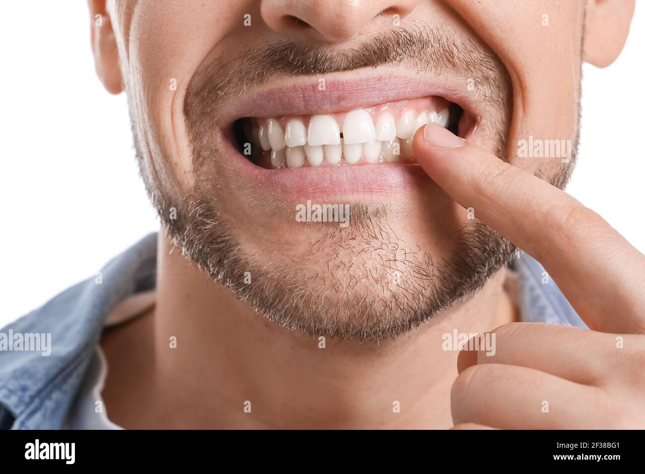 Man suffering from tooth ache on white background, closeup Stock Photo ...