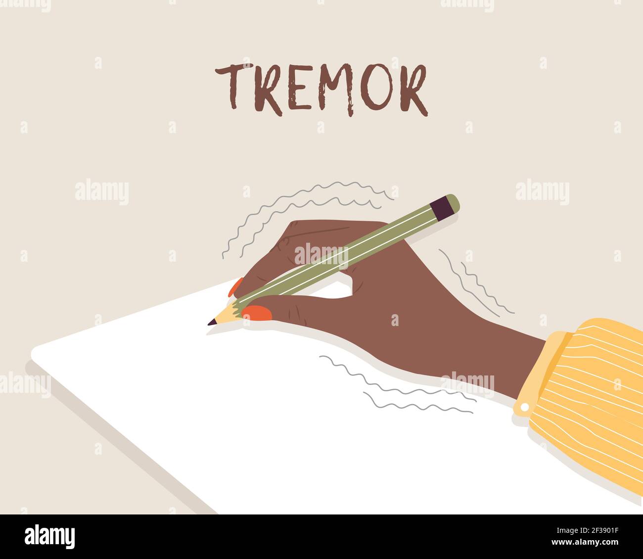 Tremor hands. Primary symptom Parkinson disease. Arms writing with a ...