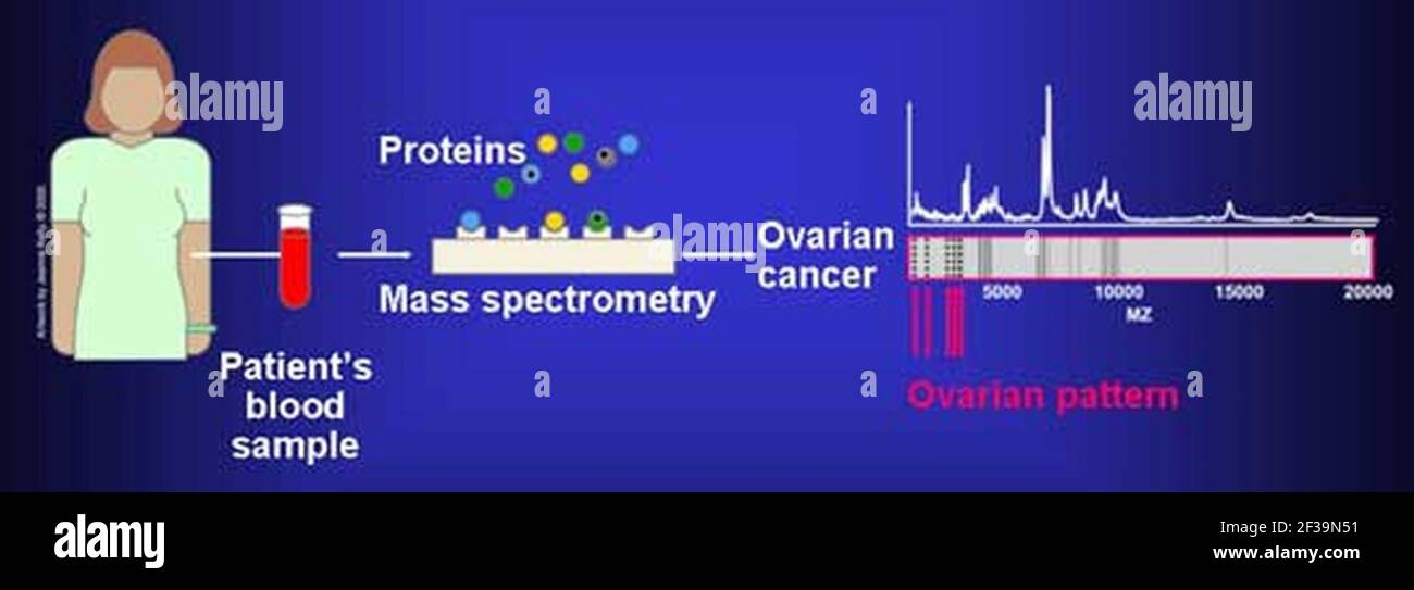 Protein Patterns and Diagnosis Stock Photo - Alamy
