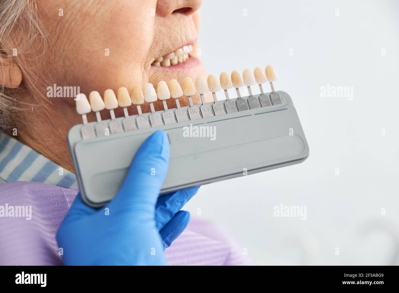 Tooth colour chart hi-res stock photography and images - Alamy