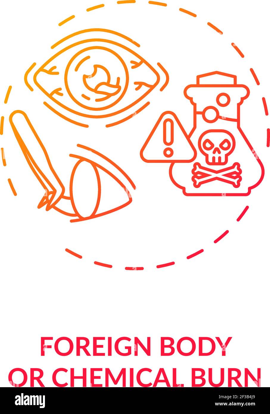 Foreign body eye Stock Vector Images - Alamy