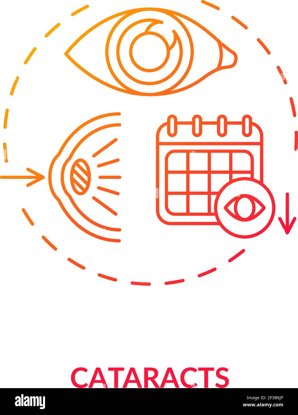 Eye cataracts Stock Vector Images - Alamy