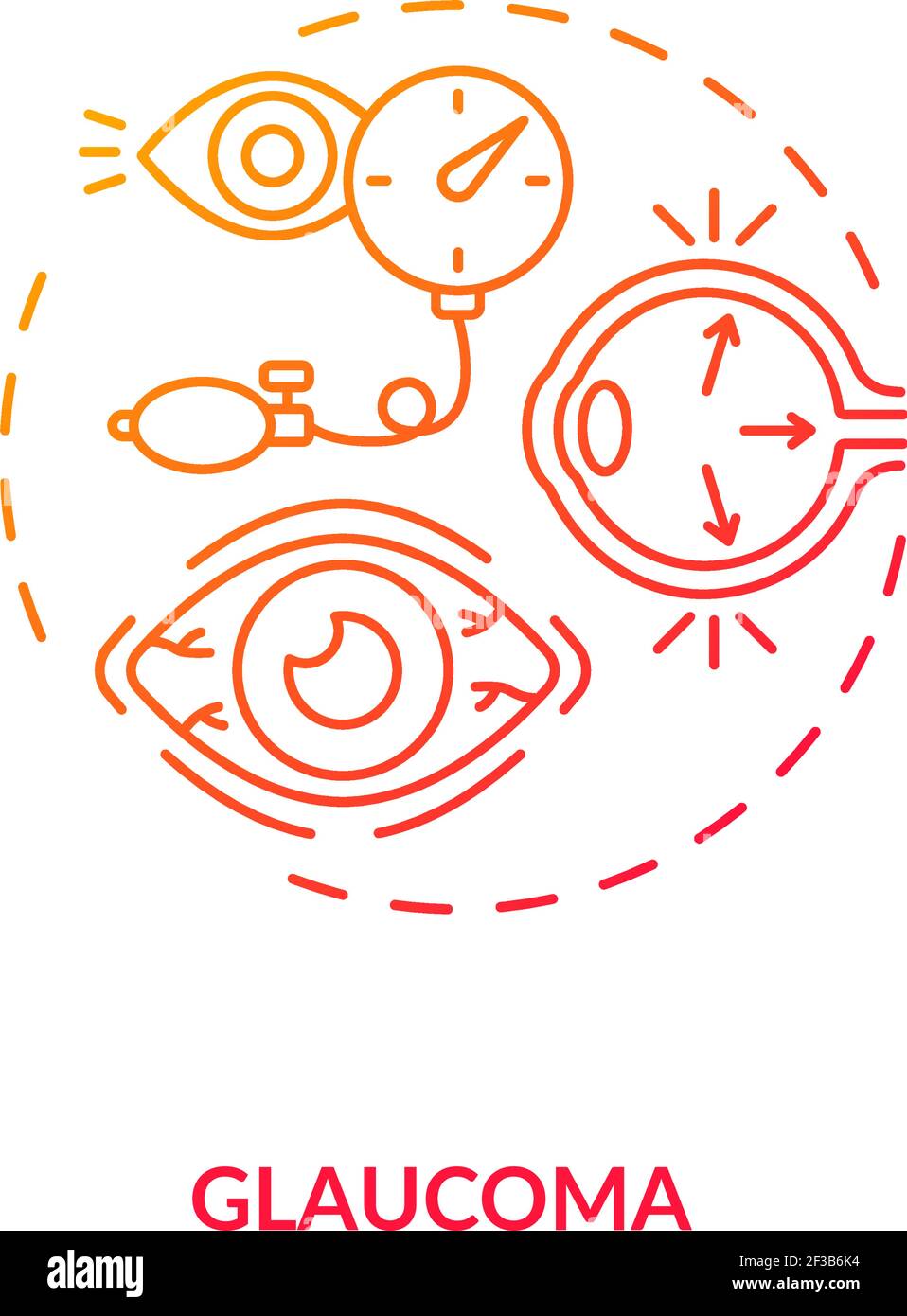 Glaucoma drawing Cut Out Stock Images & Pictures - Alamy