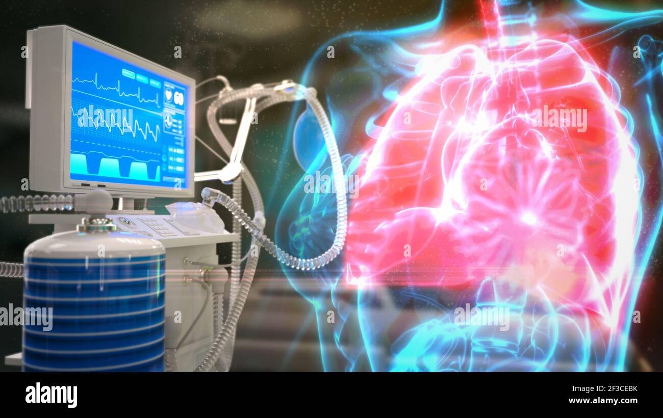 cg medical 3d illustration, human lungs and ICU medical ventilator ...
