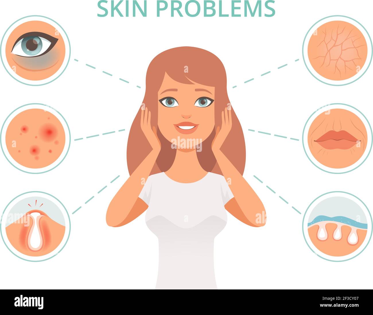 Skin Problems Beauty Woman Scrub Care Face Infection Darkness Scrubs