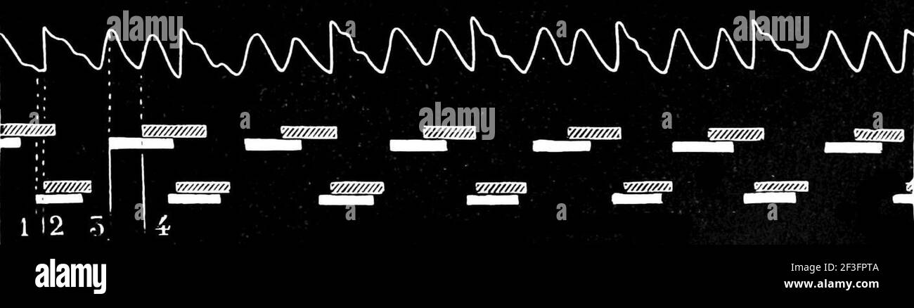 Notations of a full gallop Stock Photo - Alamy