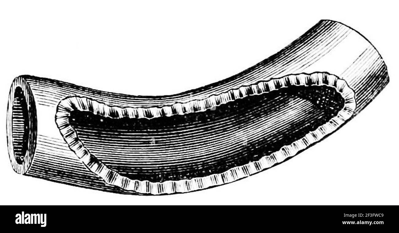 Lead pipe hi-res stock photography and images - Alamy