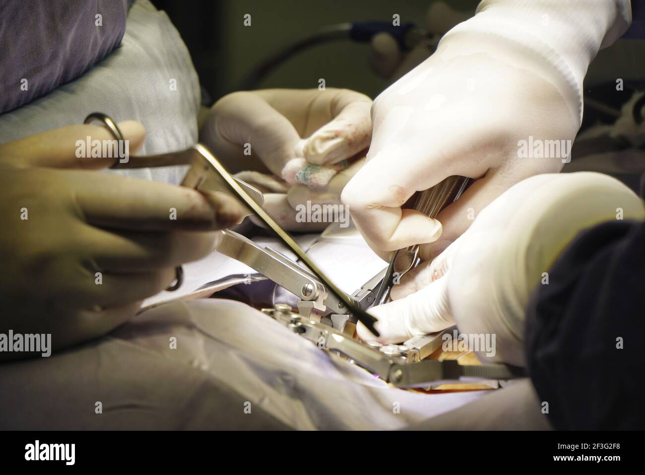 Human spine surgical tools hi-res stock photography and images - Alamy