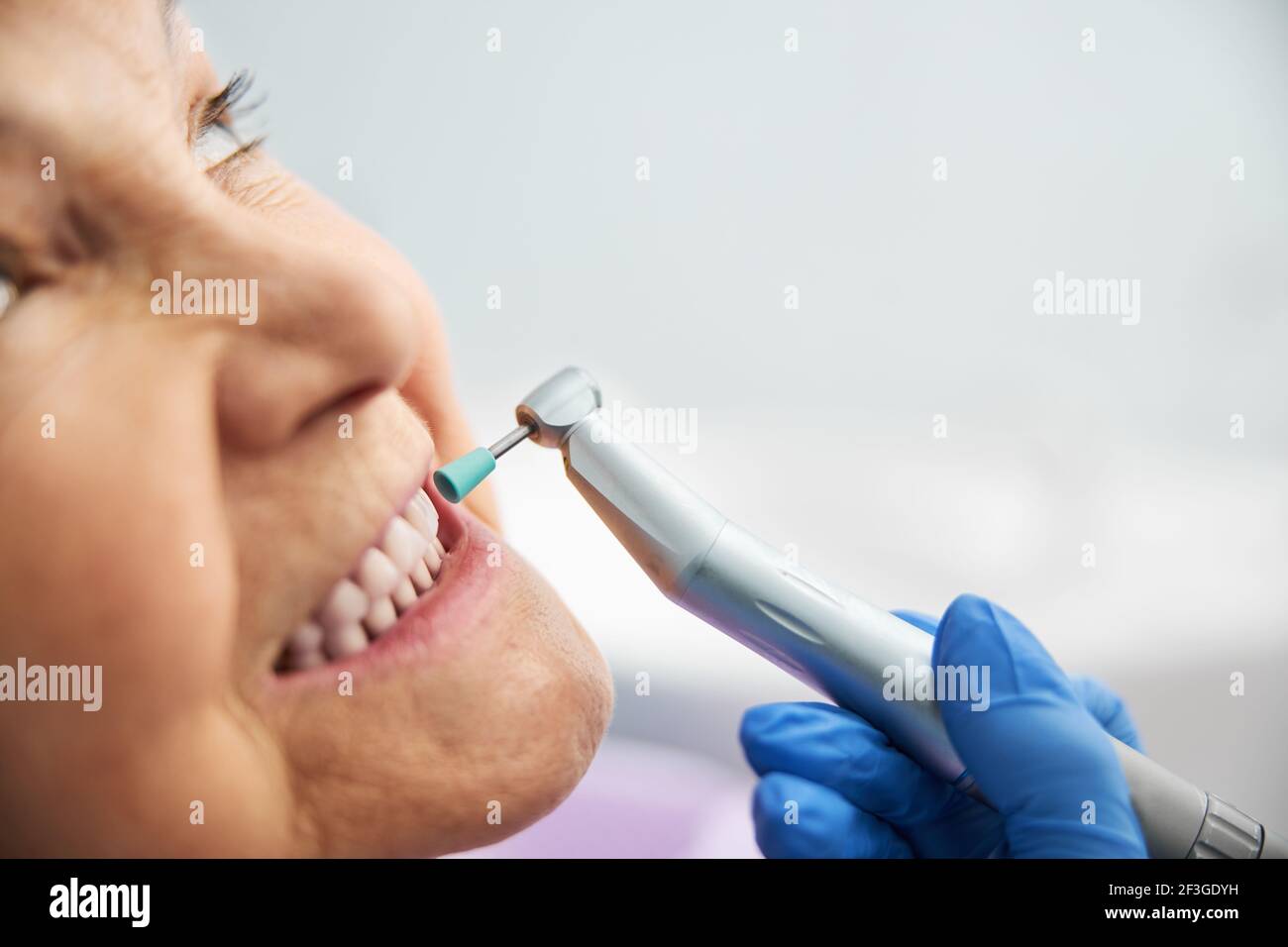 Polishing of senior woman teeth with prophy cup Stock Photo - Alamy
