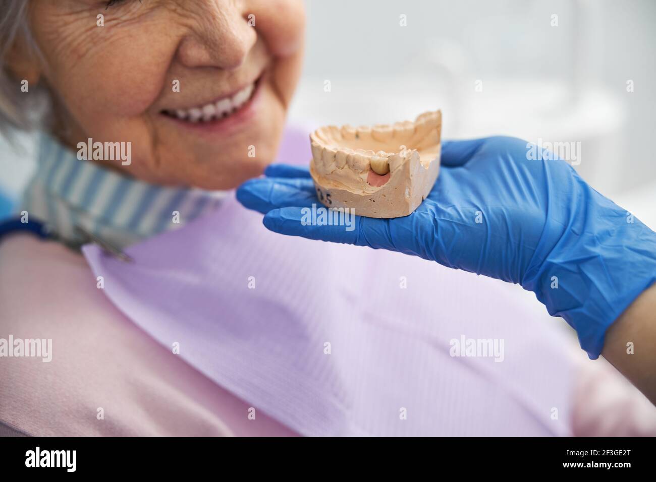Dental mold of lower teeth close to old female face Stock Photo - Alamy