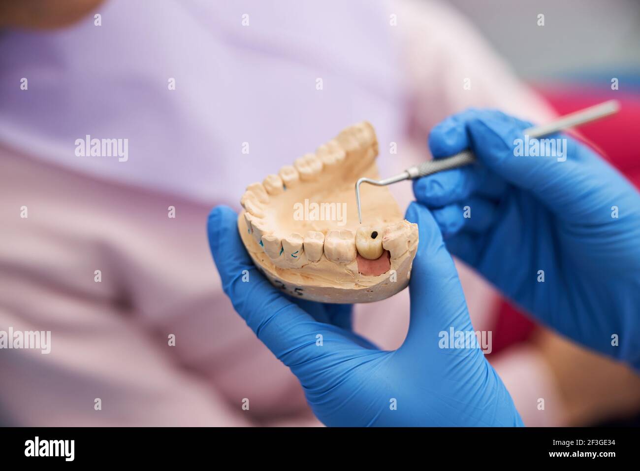 Periodontal probe hi-res stock photography and images - Alamy