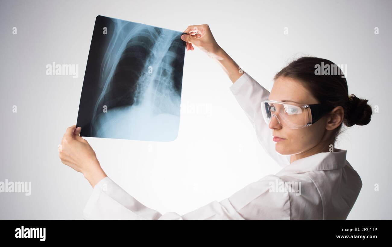 Doctor looking chest x-ray Stock Photo - Alamy