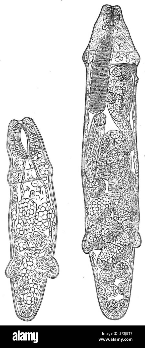 Young redia forming into liver fluke Stock Photo - Alamy