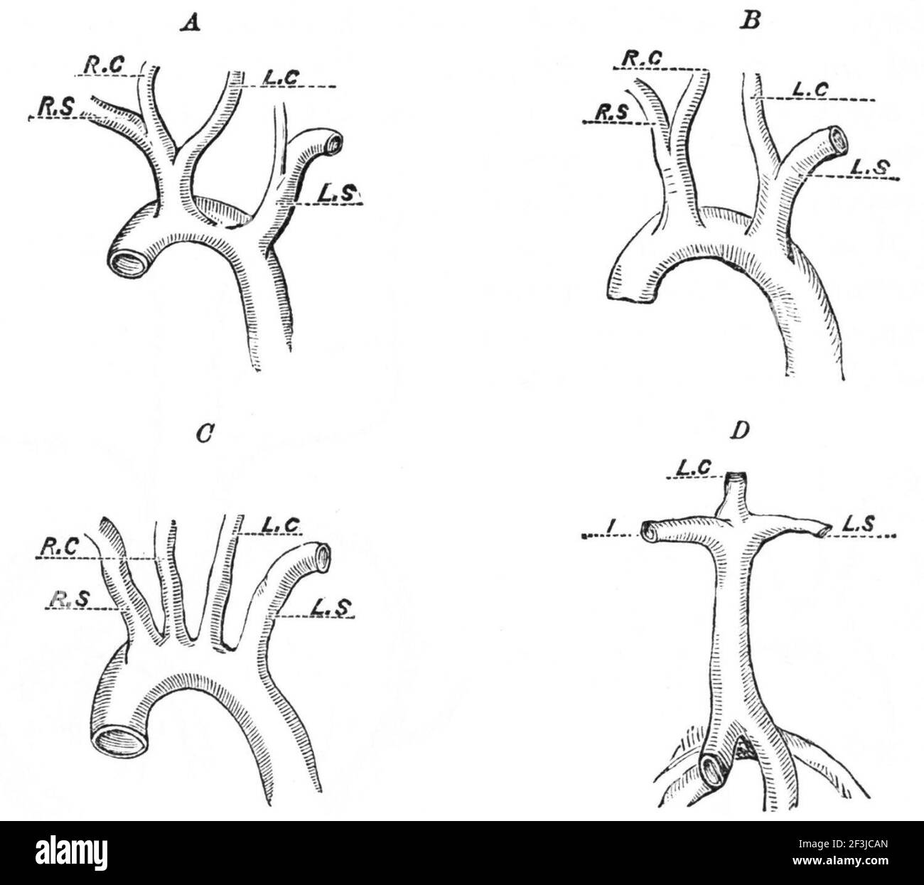 Carotid subclavian and innominate arteries Stock Photo - Alamy