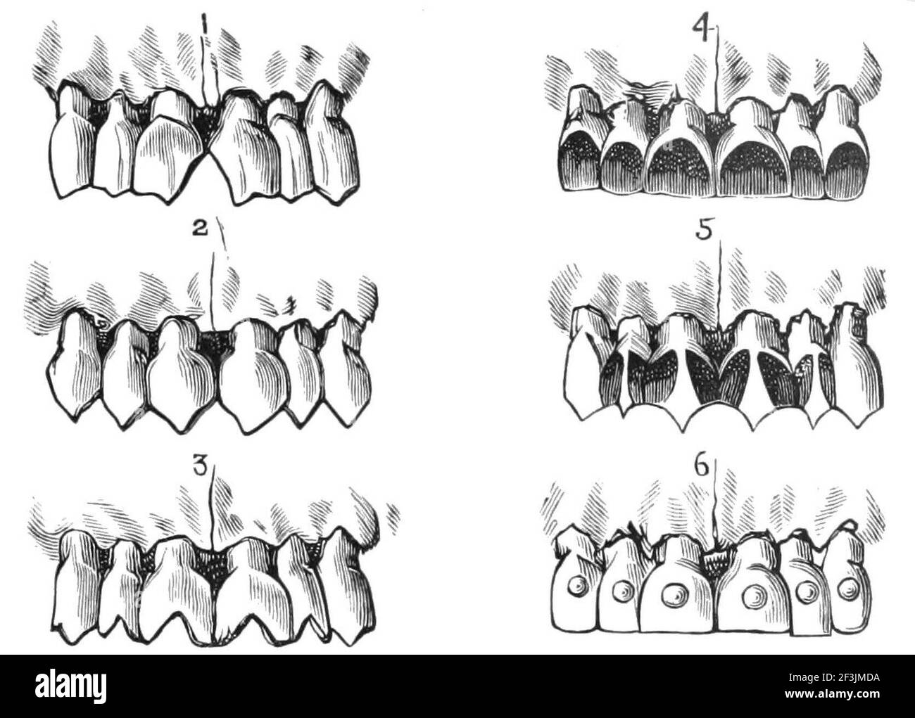 Malaysian examples of tooth filing Stock Photo - Alamy