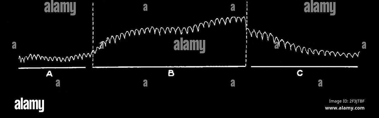 Tracing the brain when the body is in two different positions Stock ...