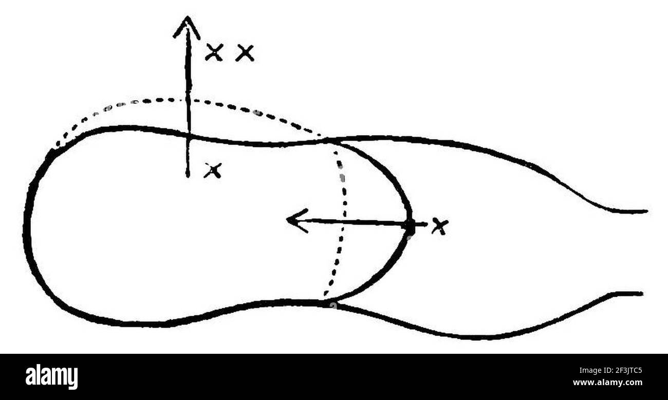 Abdominal wall and intestine movement in a prone position Stock Photo ...