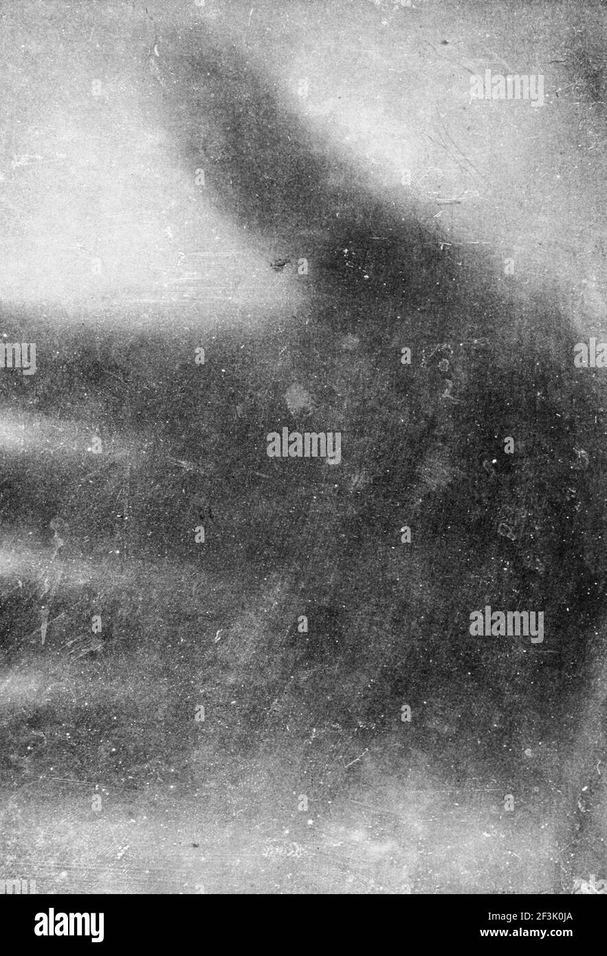 First x ray hi-res stock photography and images - Alamy