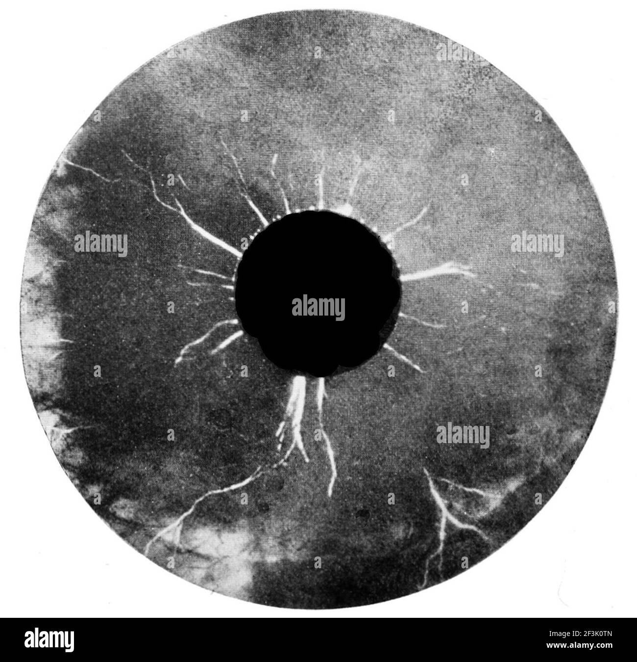 Artificial solar eclipse Stock Photo - Alamy