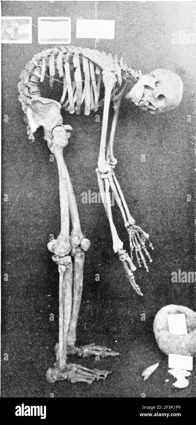 Ossified skeleton of an aged elder from robles rancheria Stock Photo ...