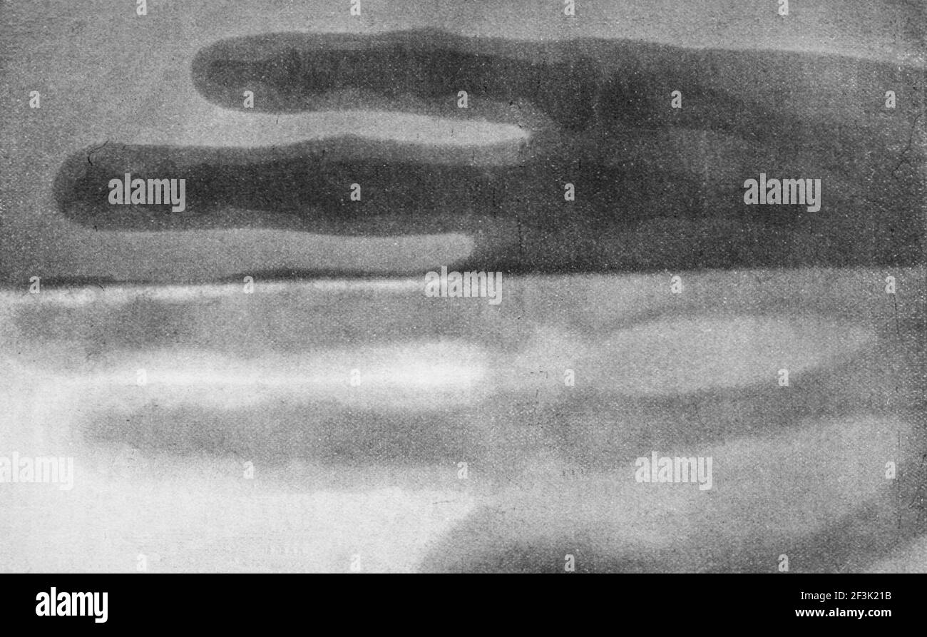 Effect of 12 second fluorescent screen exposure Stock Photo - Alamy