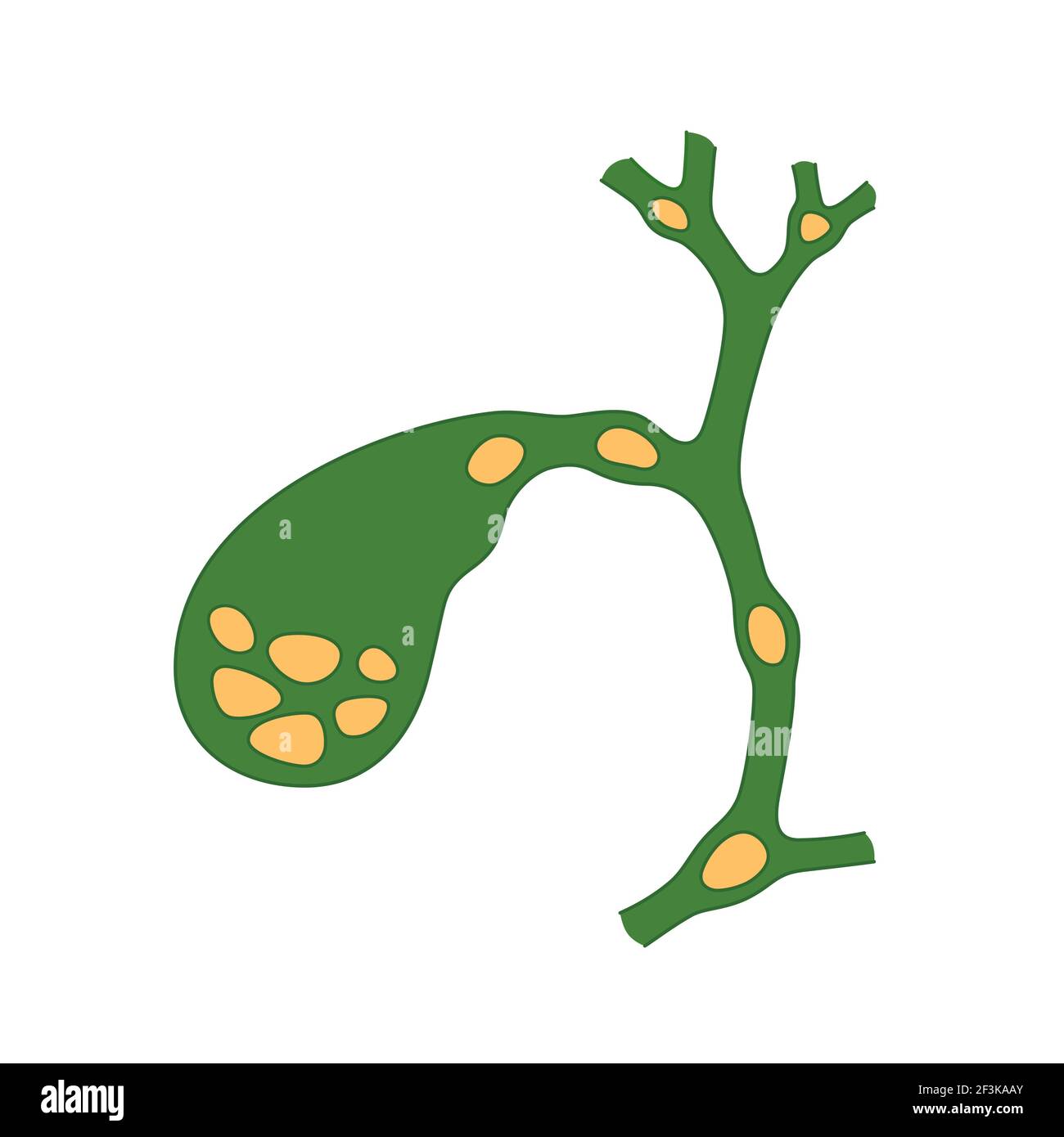 Gallbladder Drawing