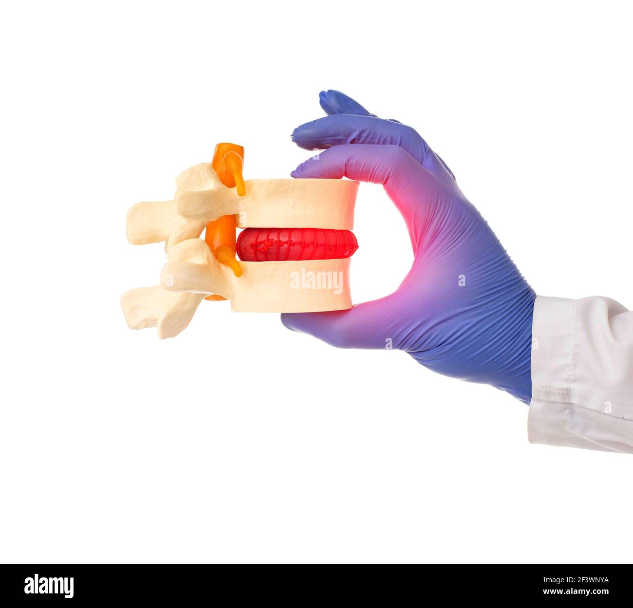 Doctor holds a segment of the human spine in his hand on a white ...