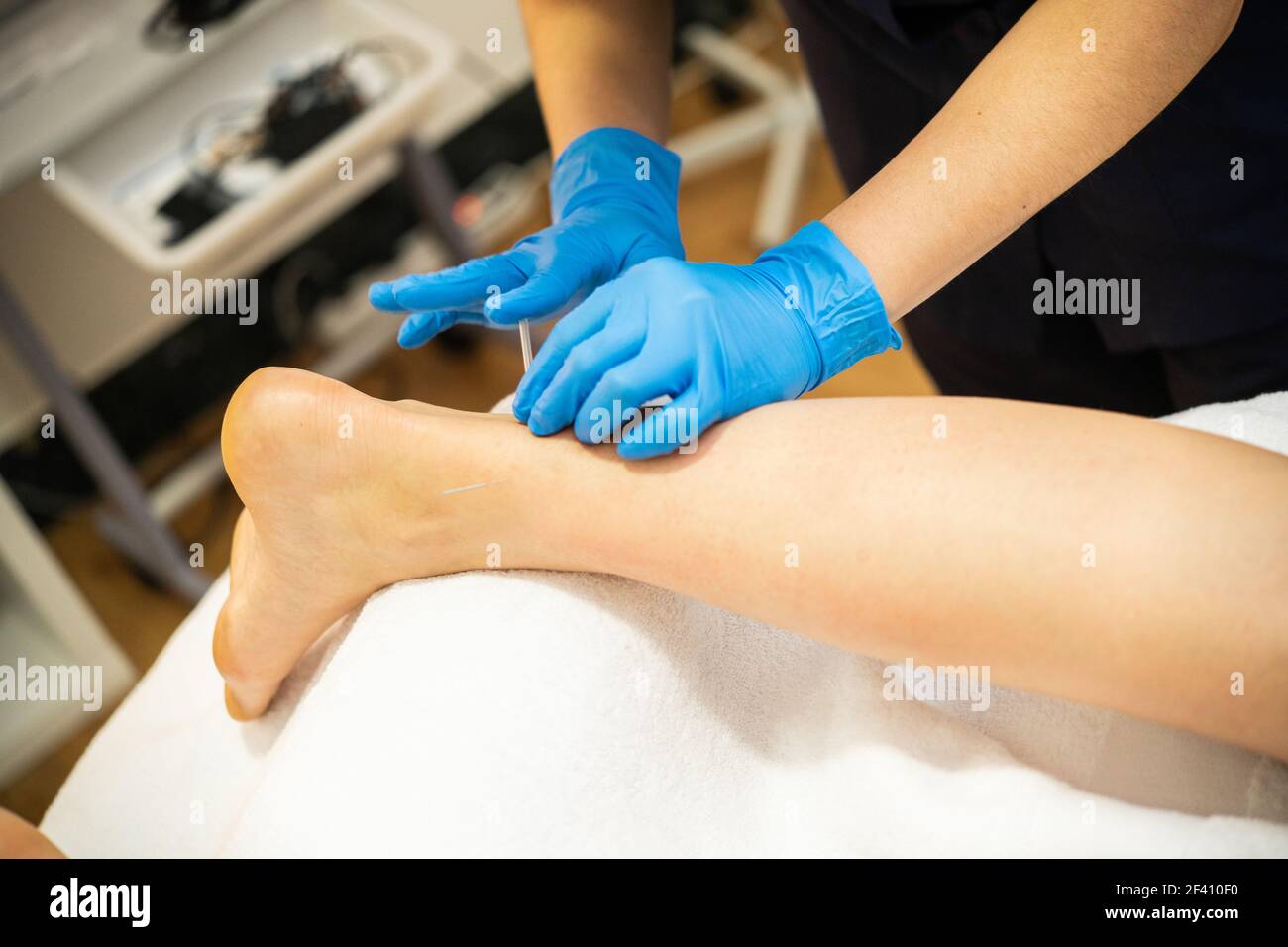 Acupuncture center hi-res stock photography and images - Alamy