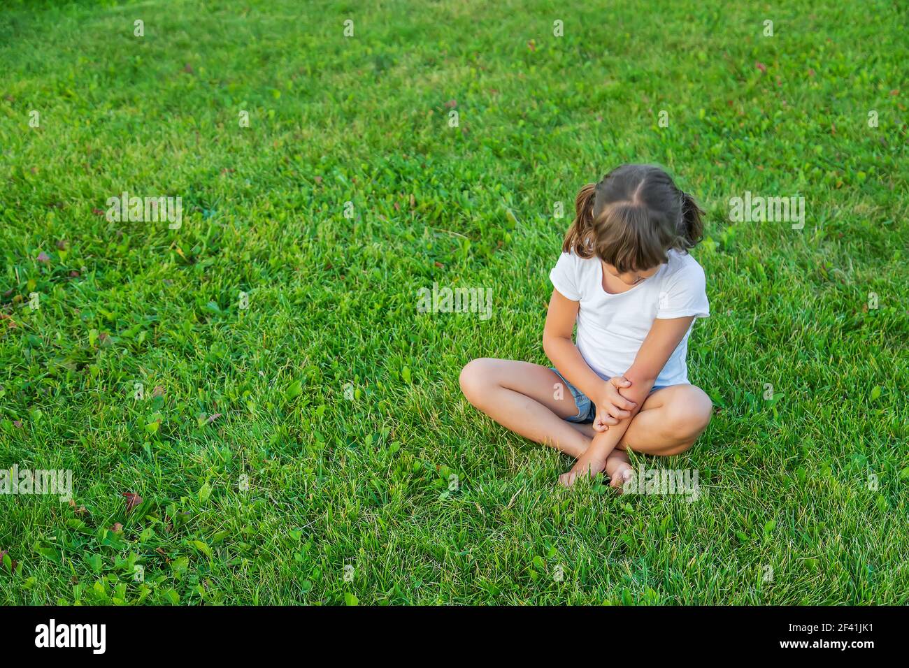 Child bitten skin hi-res stock photography and images - Alamy
