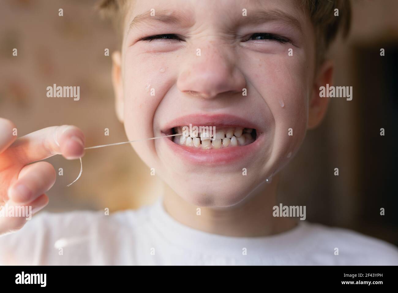 photo of crying 6 years boy who is trying to tear up his milk tooth by ...
